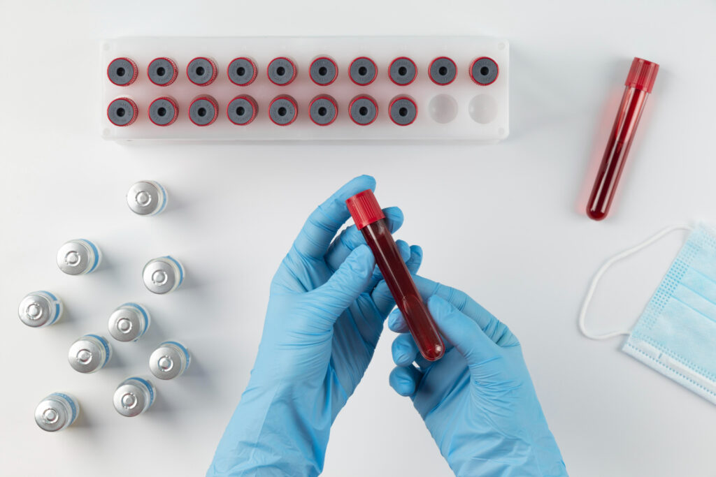 Can Blood Work Detect STDs? - Kentucky Magazine